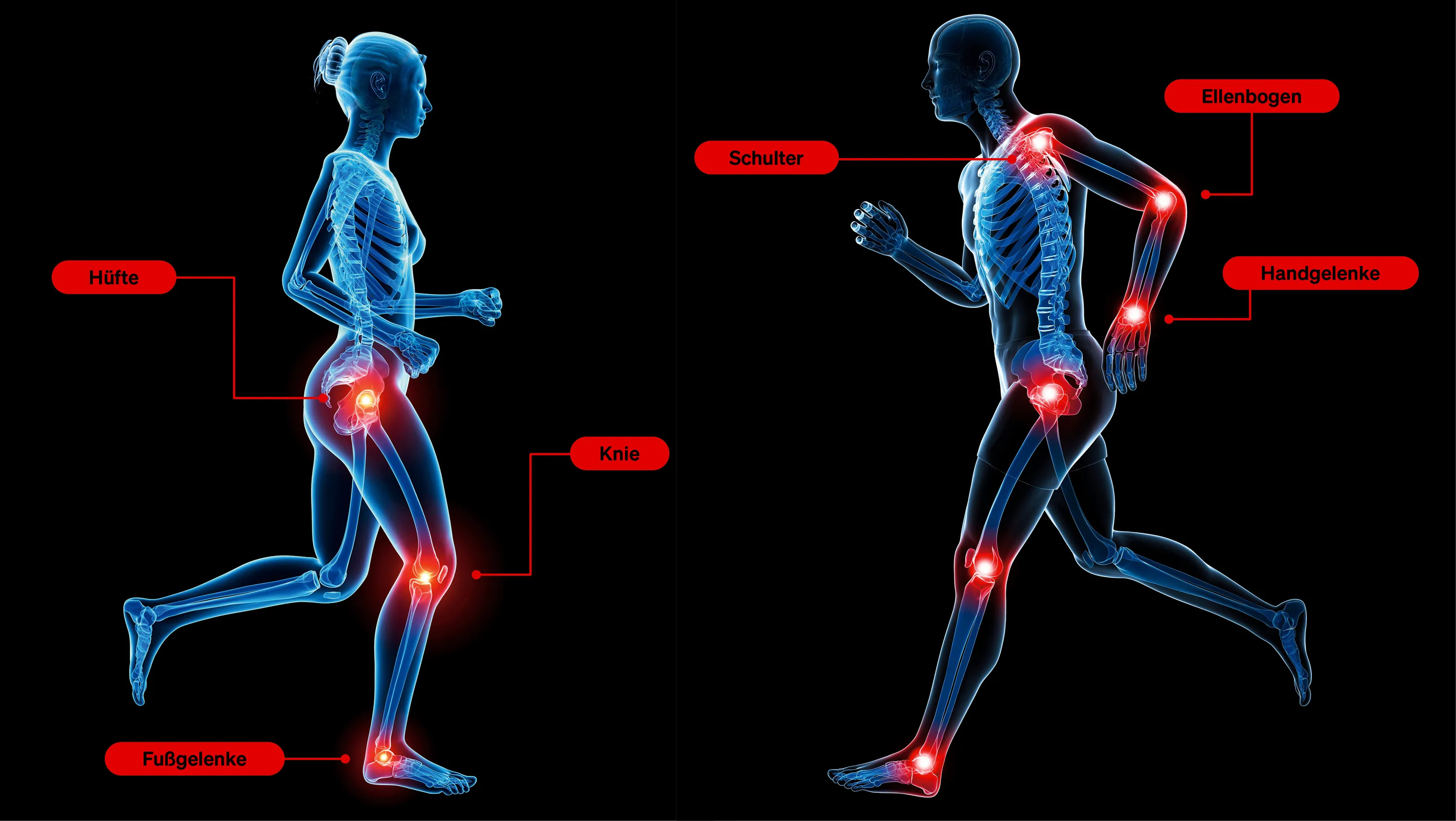 Arthrose: Gewichtsverlust ist ein entscheidender Faktor